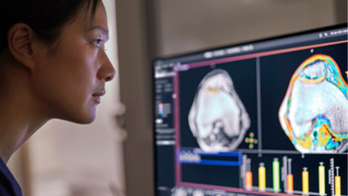 MR Workspace | Philips